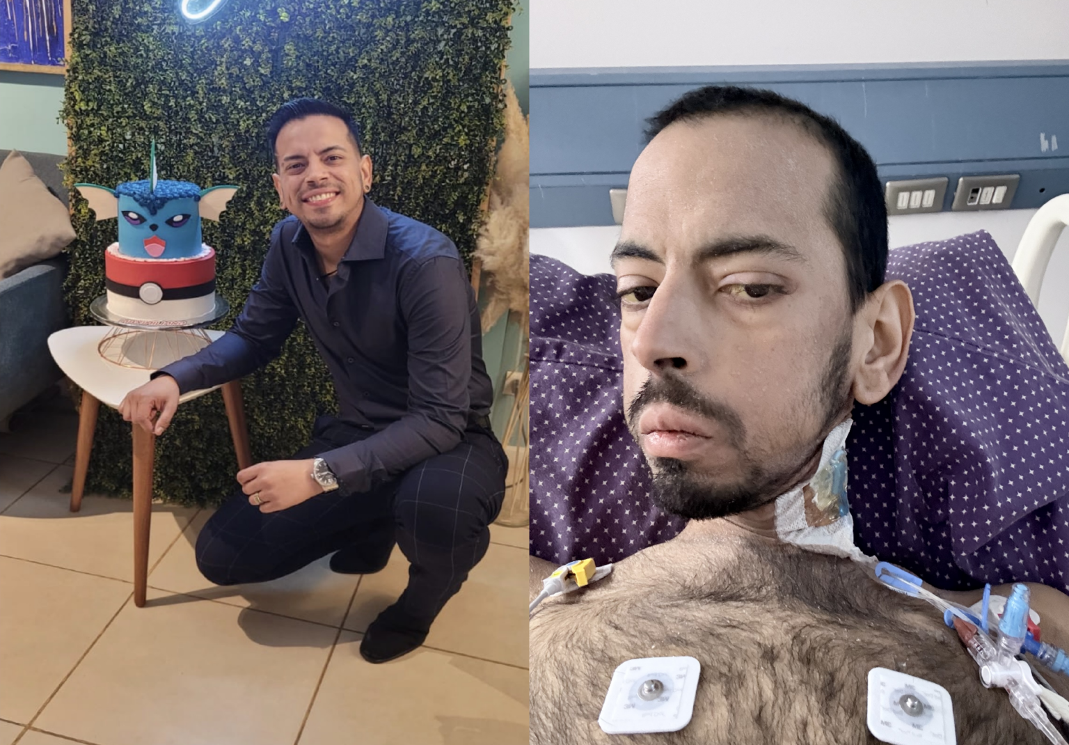 Maximiliano José Herde, venezolano en Chile necesita ayuda urgente para ...